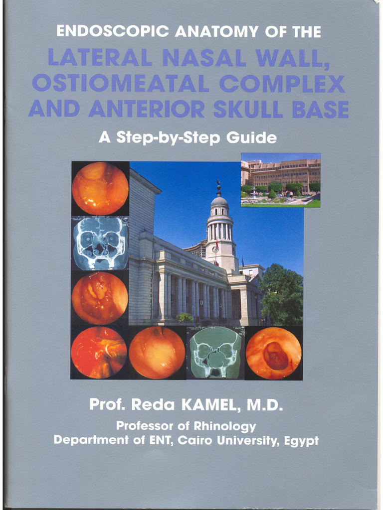 Endoscopic Anatomy of The Lateral Nasal Wall, Osteomeatal Complex and ...