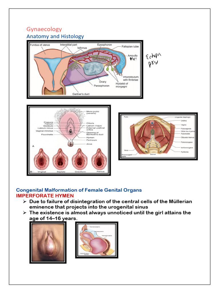 Race Annotated Gynecology | PDF | Ovarian Cancer | Uterus
