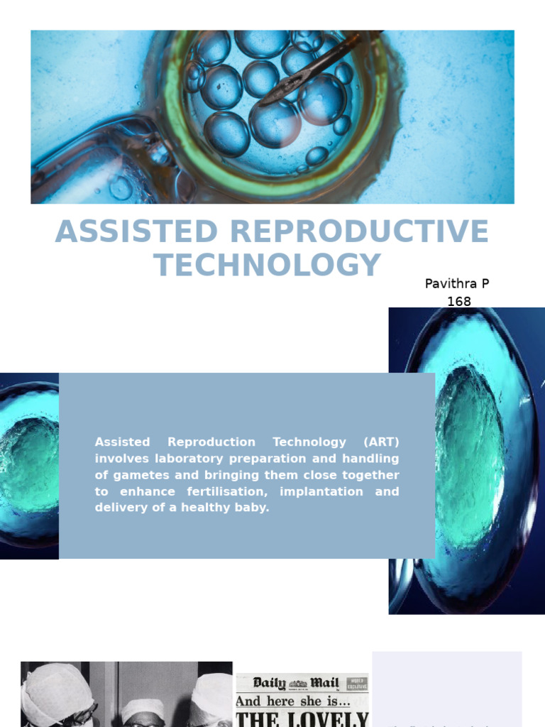 Assisted Reproductive Technology | PDF | In Vitro Fertilisation | Ovary