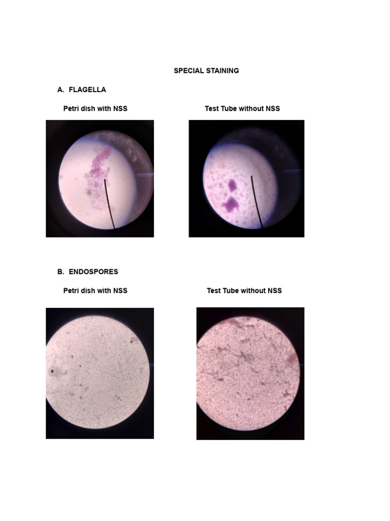 Special Staining | PDF