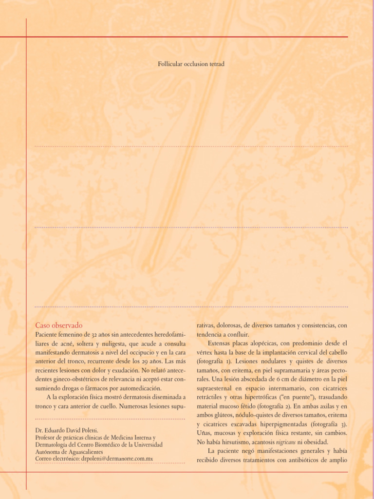 Tétrada de Oclusión Folicular | PDF | Enfermedades y trastornos ...