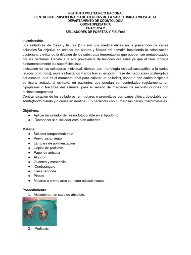 Selladores de Fosetas y Fisuras en Odontopediatría | PDF | Odontología ...