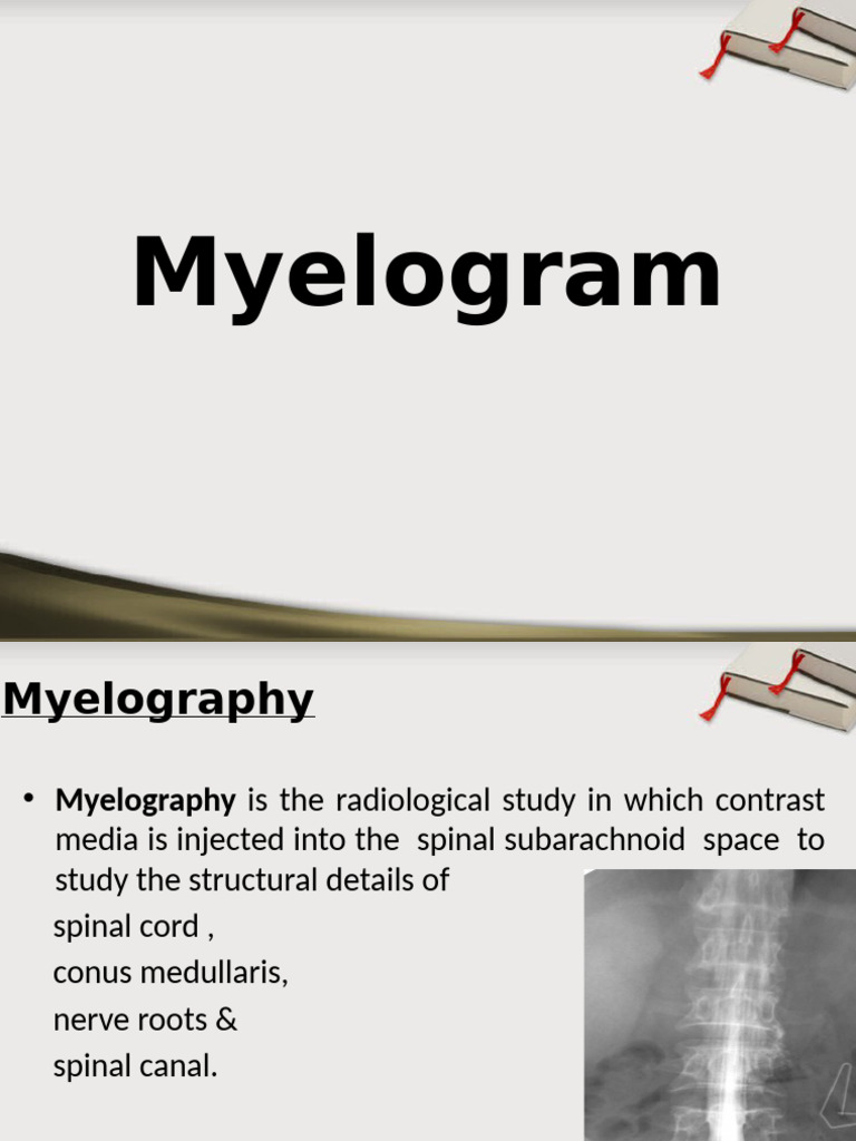 34. Myelography | PDF | Nervous System | Medical Specialties