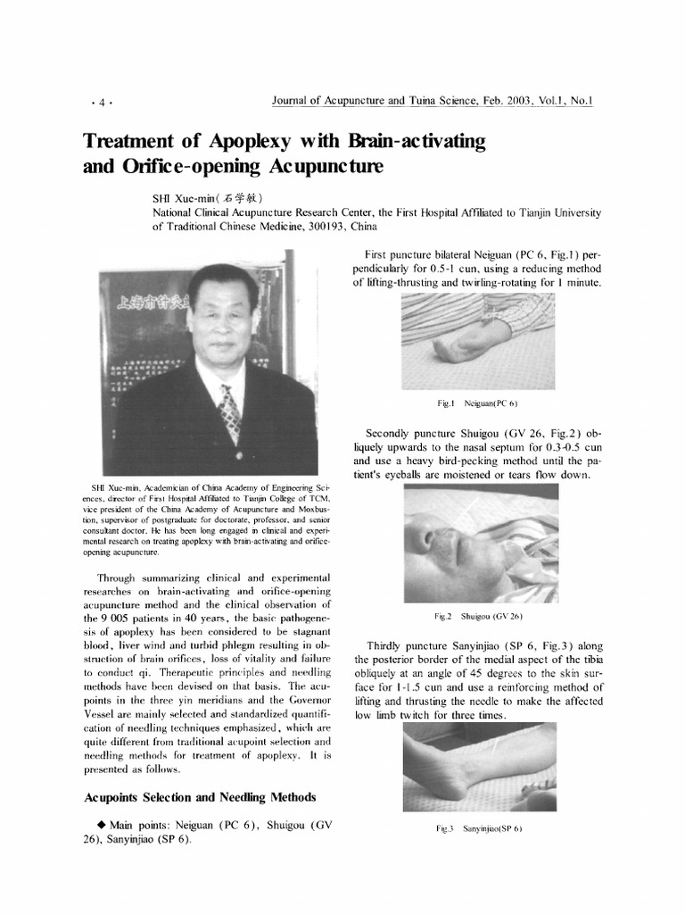 SHI XUE-min-XNKQ (Xing NaoKai Qiao) 3 | PDF | Acupuncture | Traditional ...