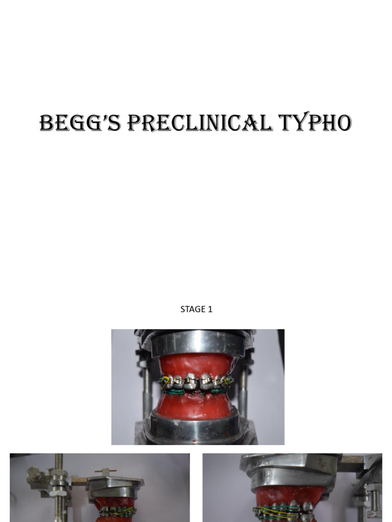 Preclinical Typho | PDF