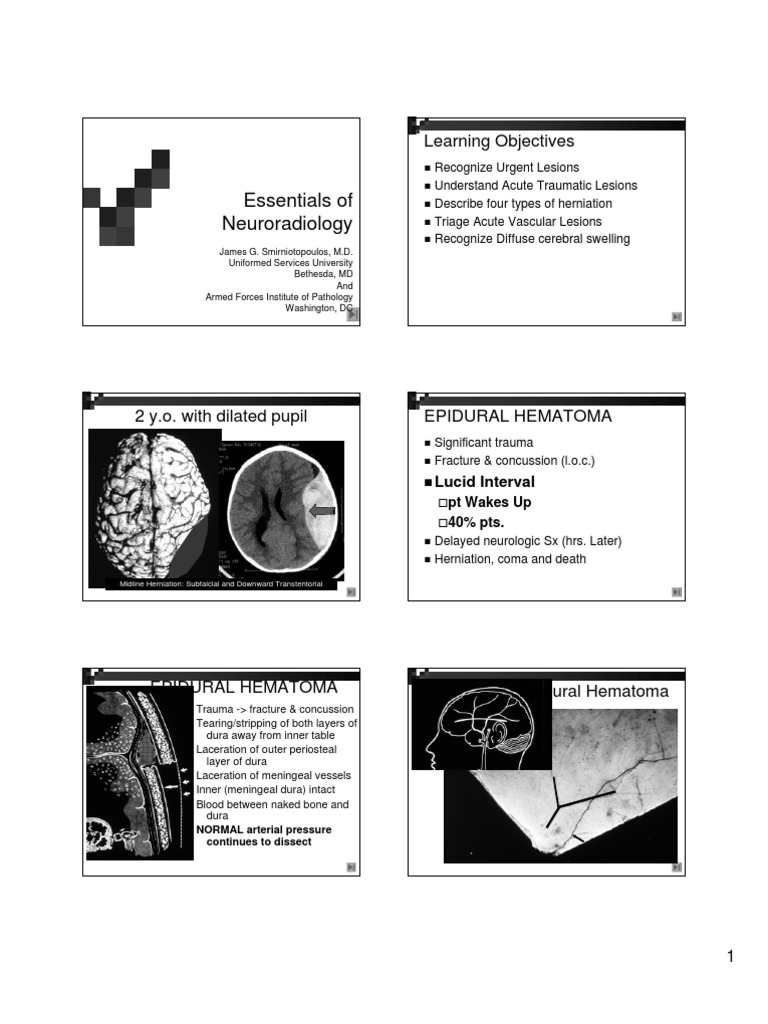 Essentials of Neuroradiology RSNA 2007 | PDF