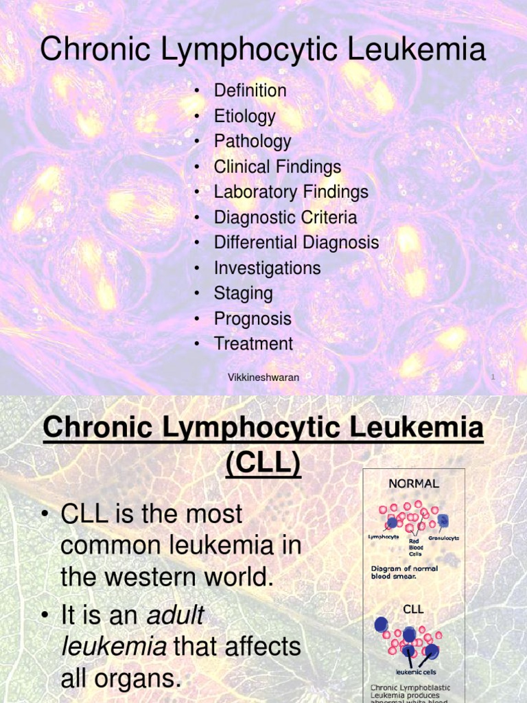 Chronic Lymphocytic Leukemia (CLL) | Leukemia | B Cell