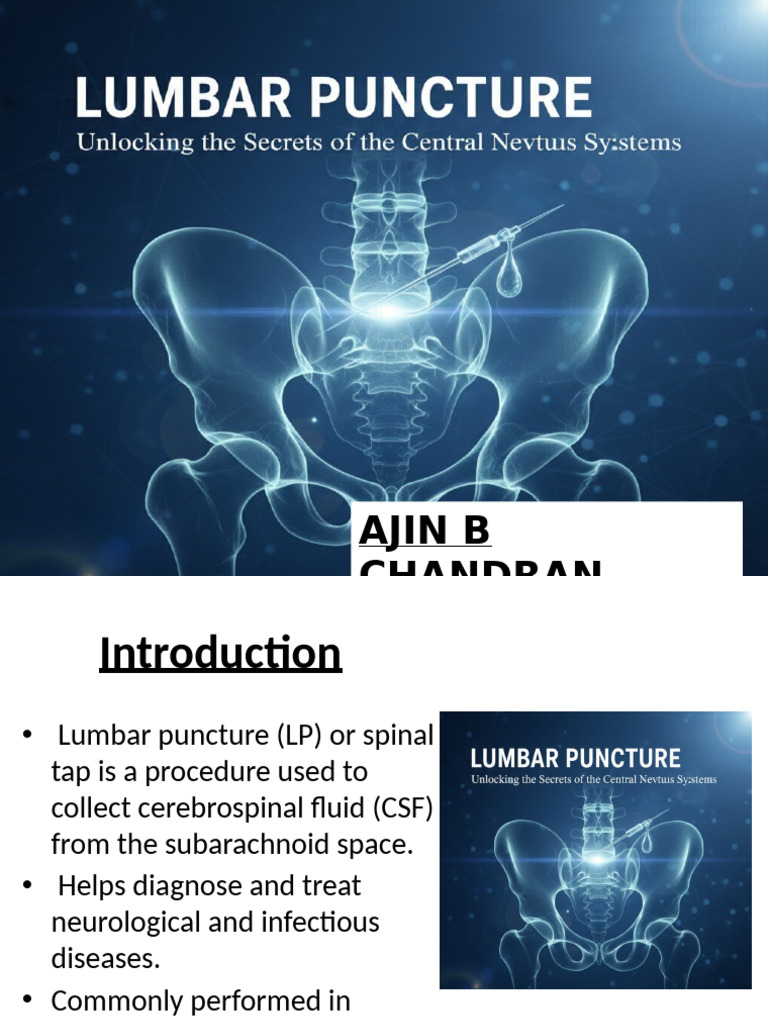 Lumbar Puncture Procedure Overview | PDF