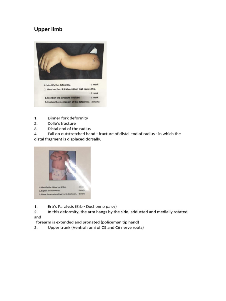 1.Upper Limb - OSPE | PDF
