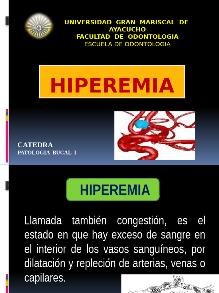 HIPEREMIA | PDF | Vena | Insuficiencia cardíaca