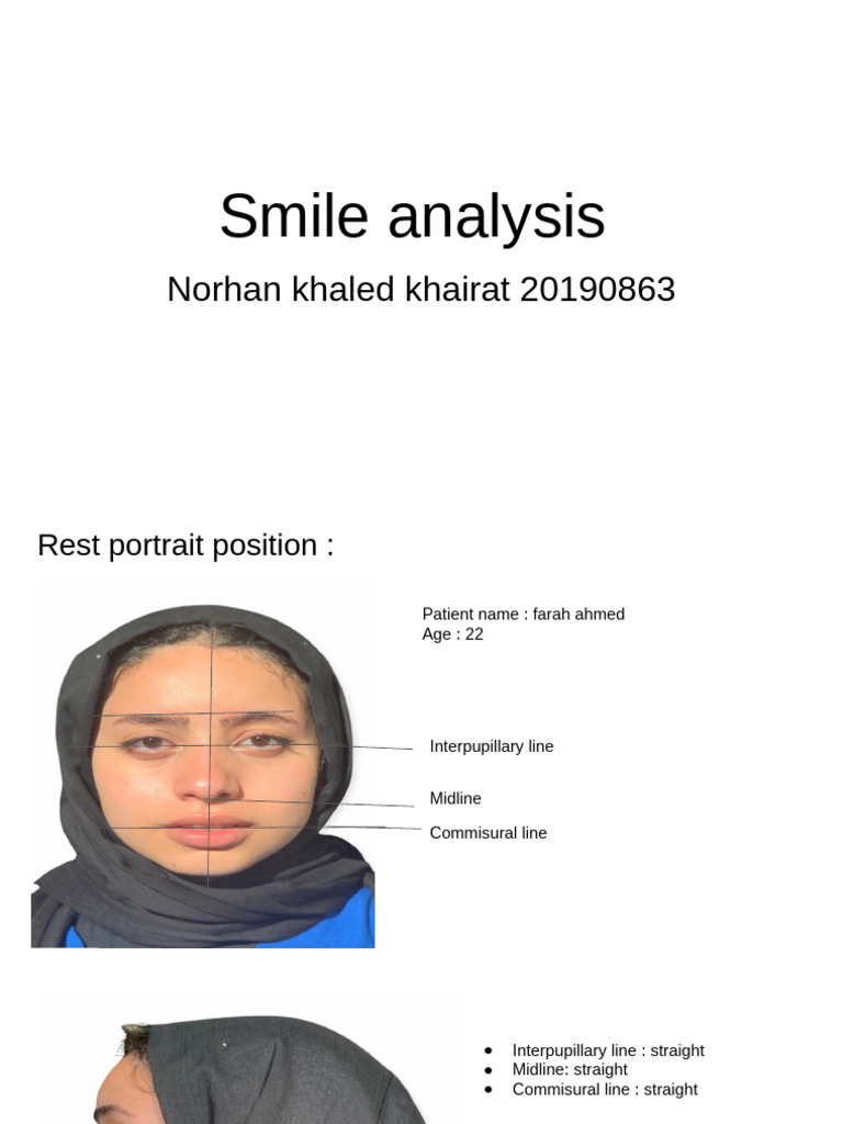 Smile Analysis | PDF