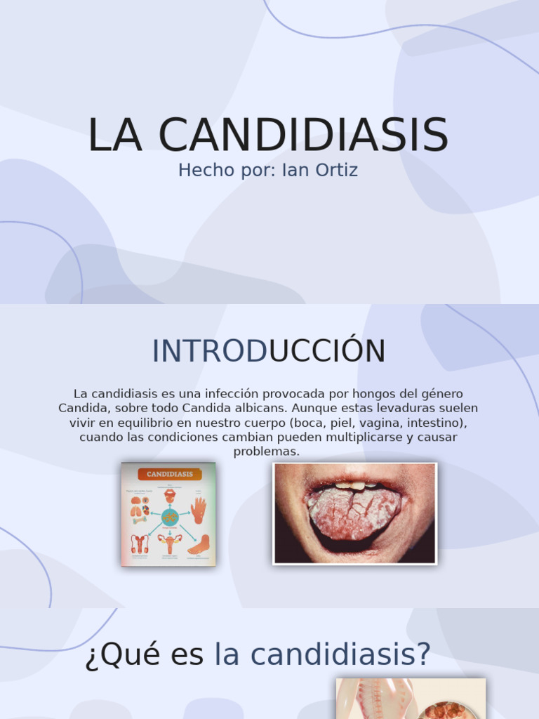 La Candidiasis | PDF | Candidiasis | Ciencias de la Salud