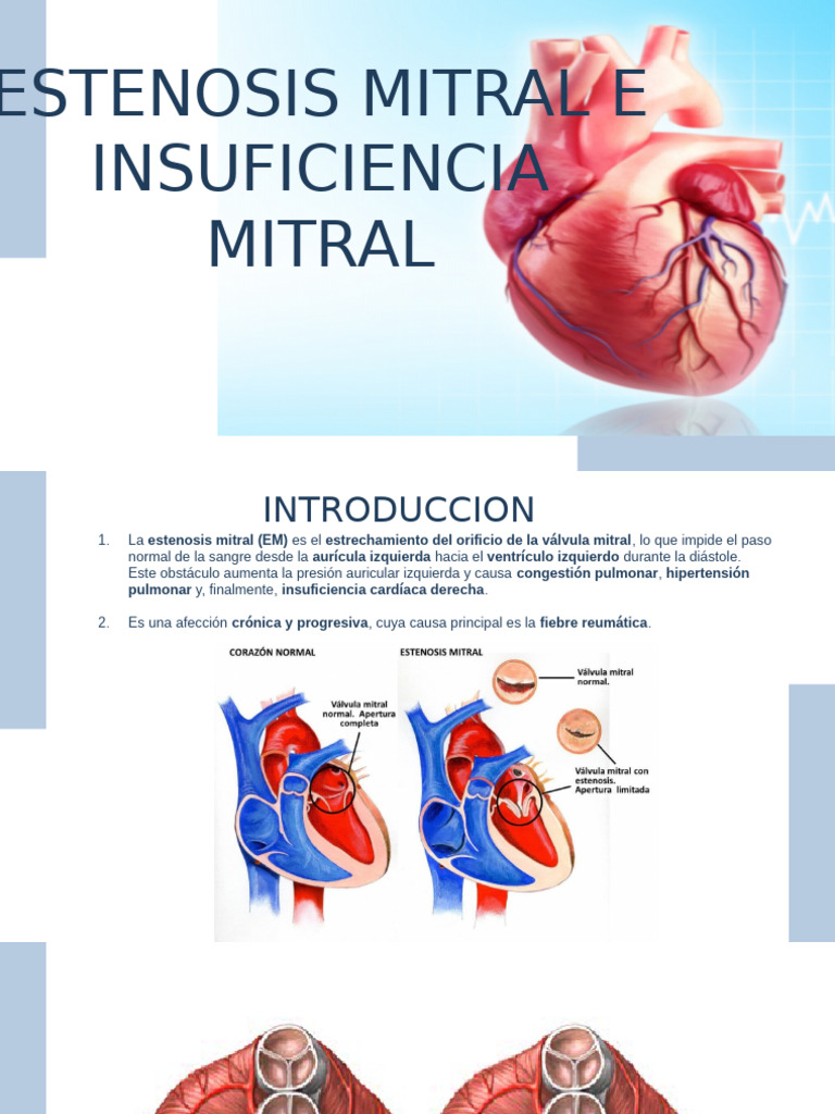 Estenosis Insufisiencia Mitral 1 Pdf Embolia Insuficiencia Cardíaca