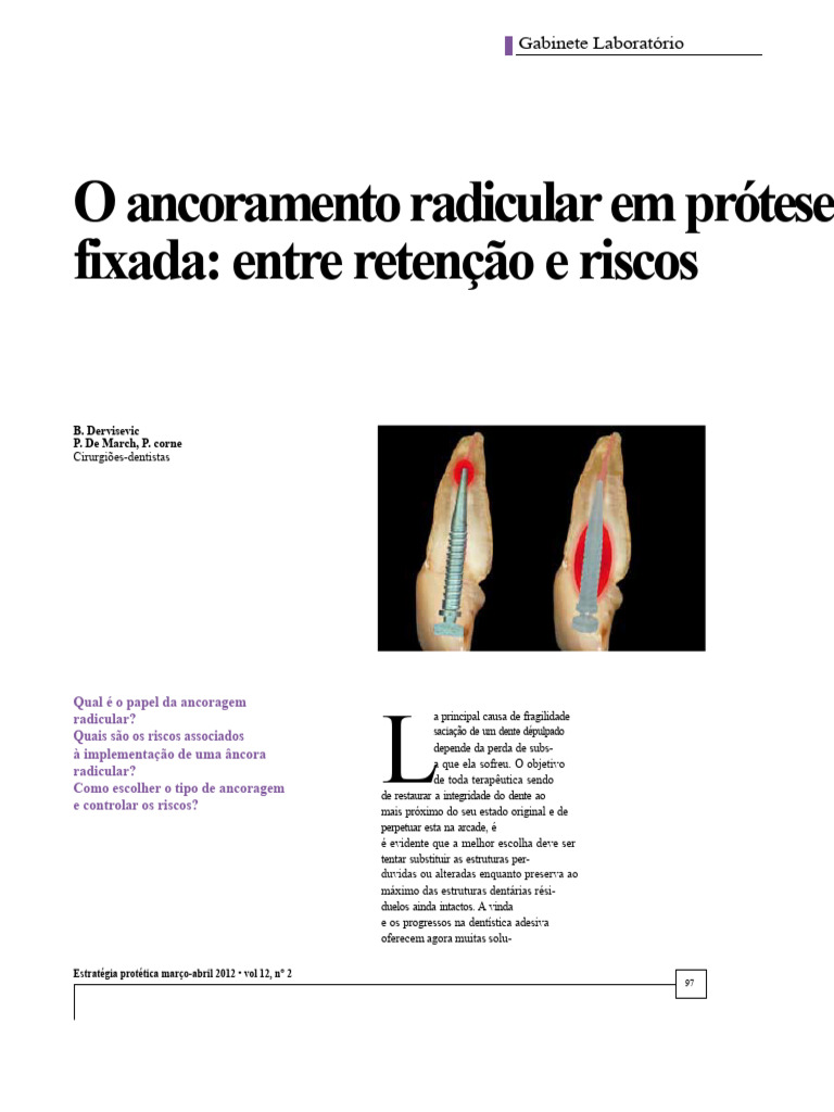 Ancoragem Radicular | PDF | Dente humano | Dentina