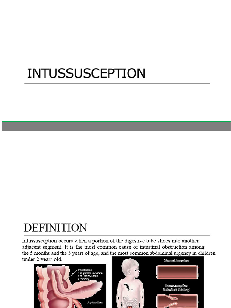 Intestinal Invagination RyD 1 | PDF | Medical Specialties | Diseases ...
