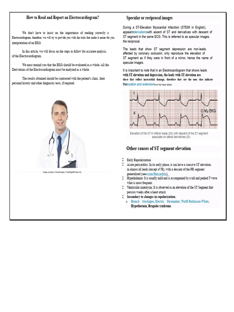 How To Read and Interpret An Electrocardiogram | PDF ...
