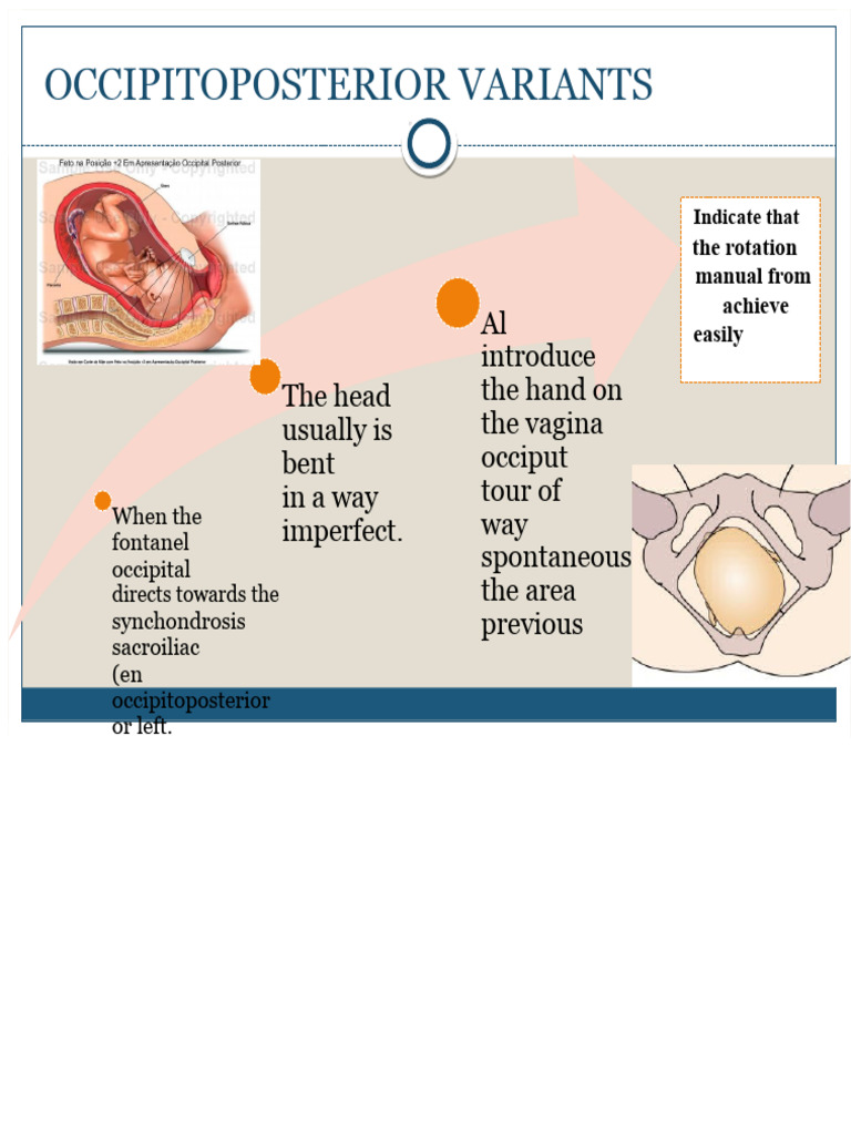 Persistent Occipito Posterior | PDF