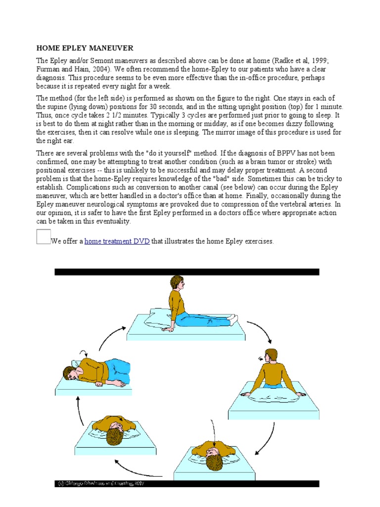 Epley Maneuver | PDF