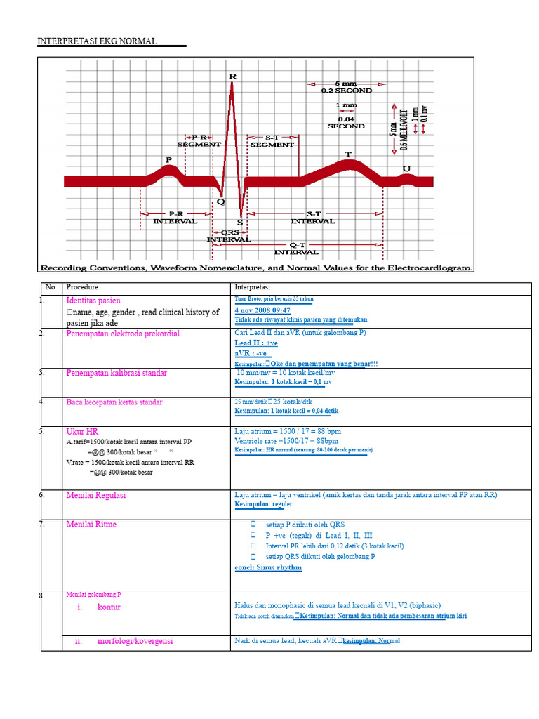 Interpretasi EKG Normal | PDF
