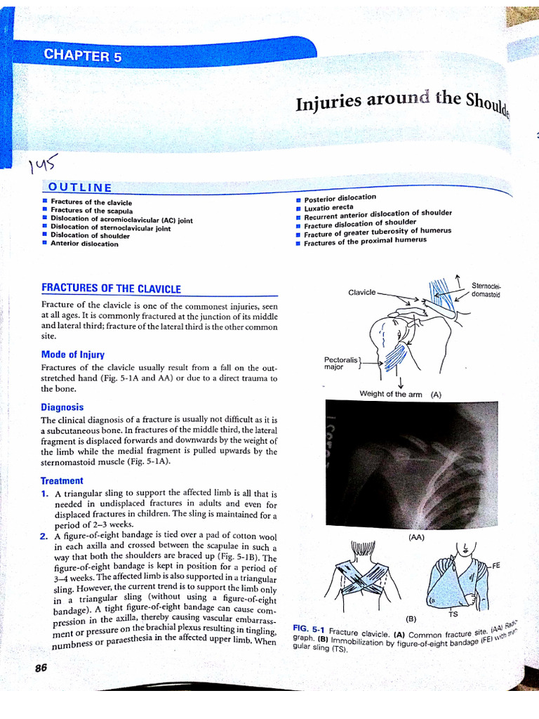 Raj Sir Documents - (E145-197) Fracture of Upperliimb-1 | PDF