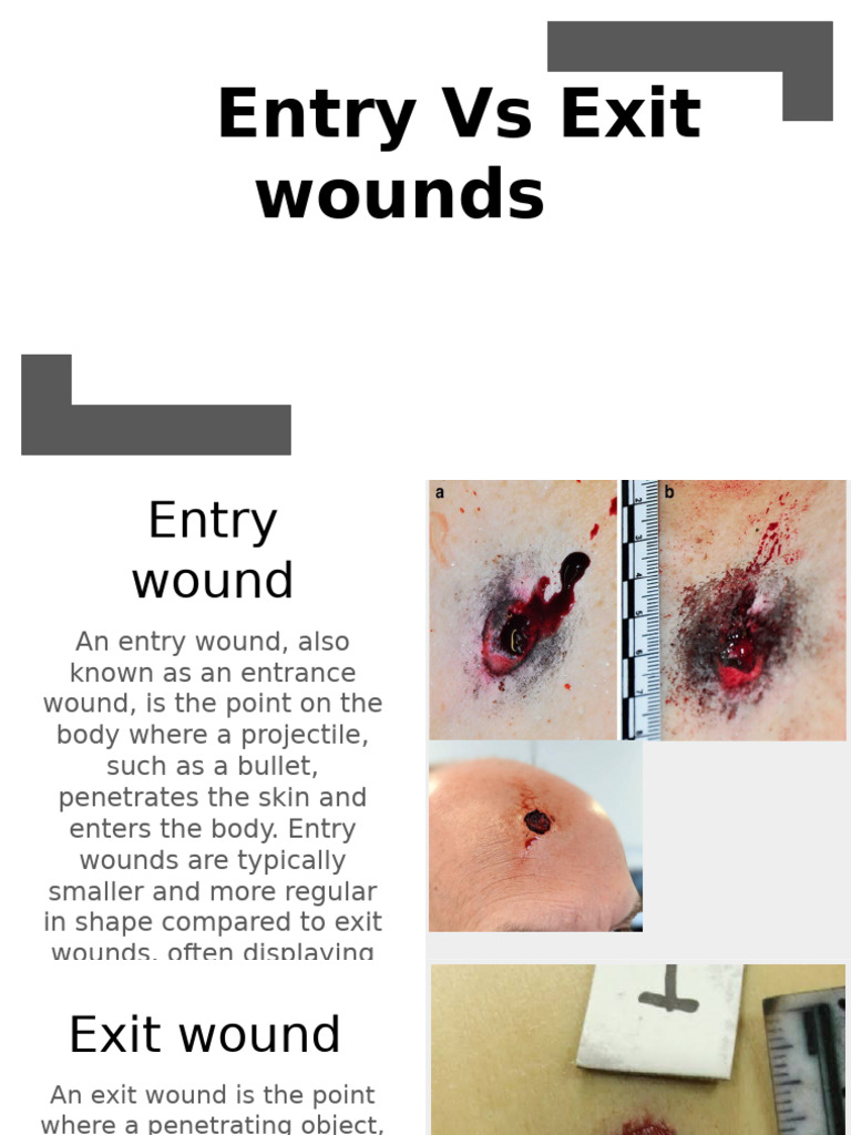 Entry and Exit Wound Characteristics | PDF | Gunpowder