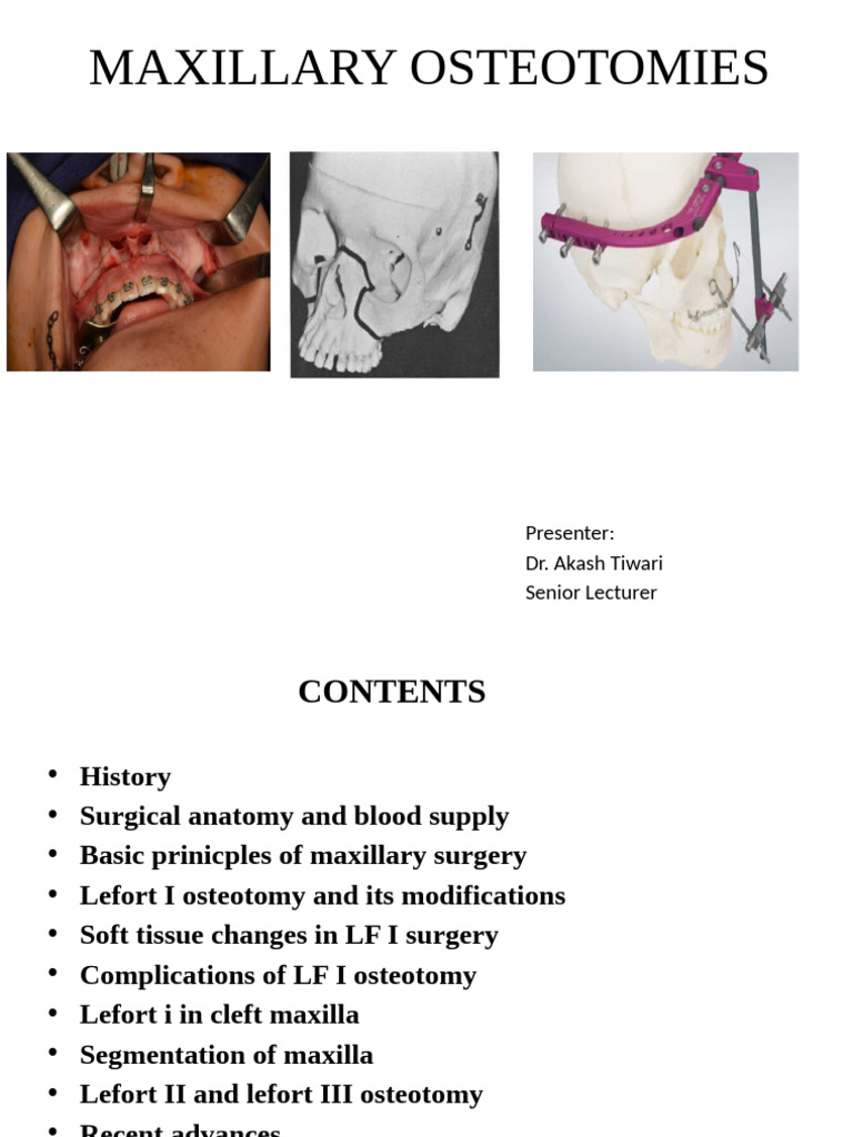 Maxillary Osteotomies Overview | PDF | Human Nose | Primate Anatomy