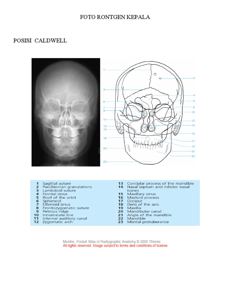 Rontgen Kepala | PDF