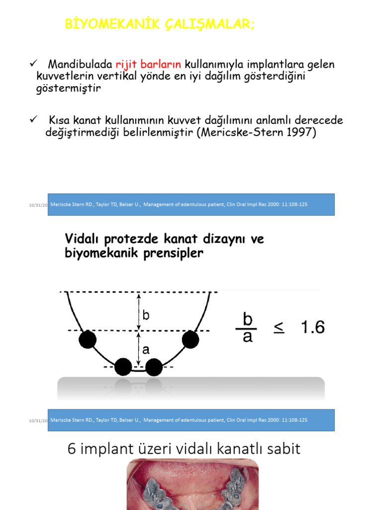 Implant Üstü Lab 4 | PDF