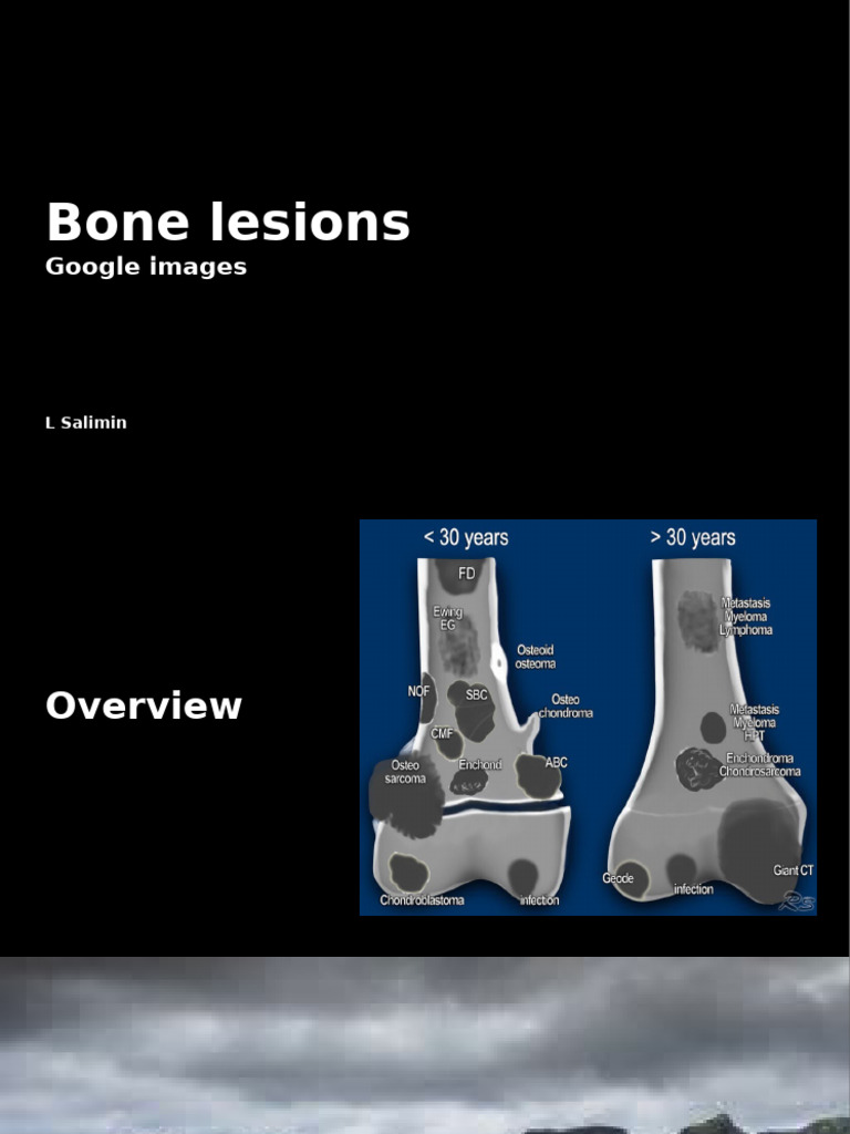 Bone Lesion Presentation 1 | PDF