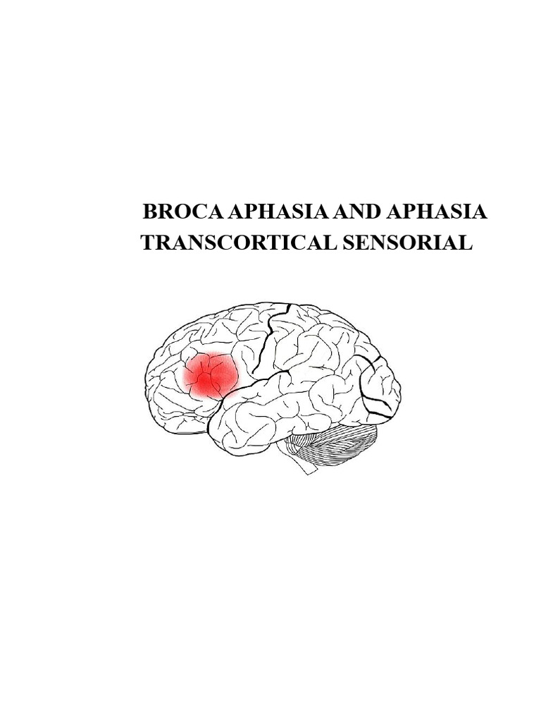 Broca's Aphasia and Transcortical Sensory Aphasia | PDF | Aphasia ...