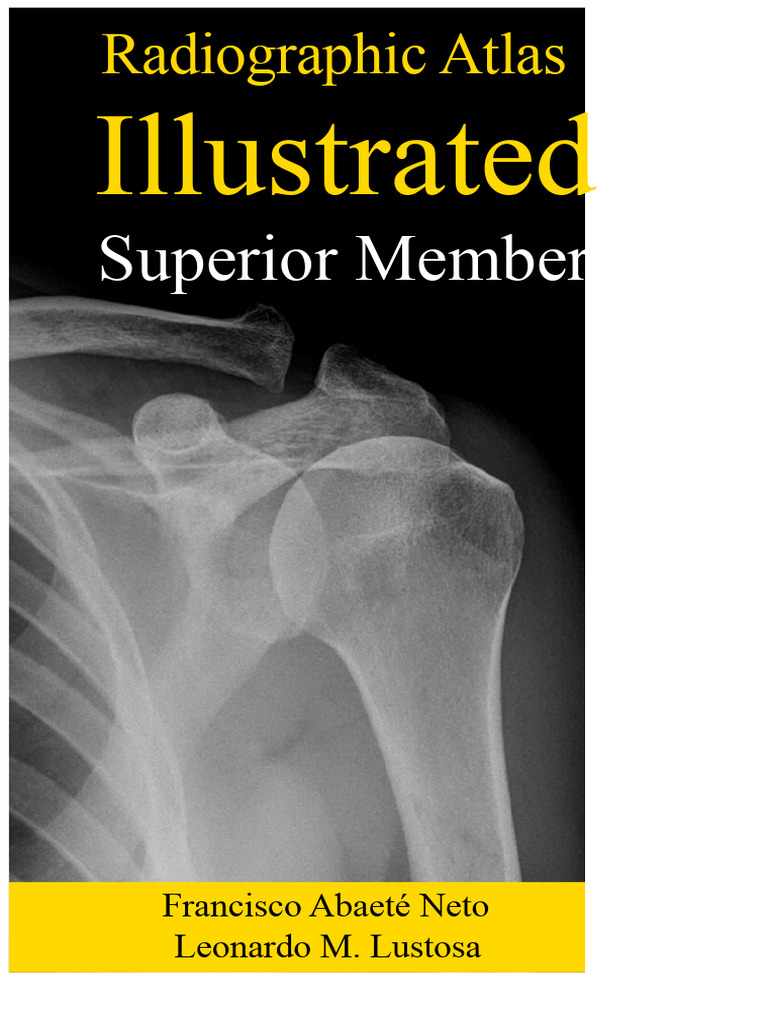Illustrated Radiographic Atlas Upper Limb | PDF | Shoulder | Hand
