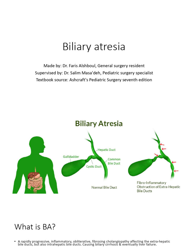 Biliary Atresia - Dr. Faris Alshboul | PDF | Liver | Medical Specialties
