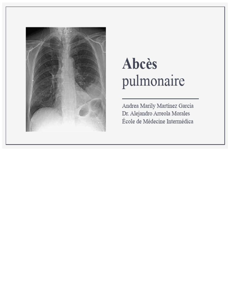 Abcès pulmonaire : définition et traitement | PDF | Pneumonie | Poumon