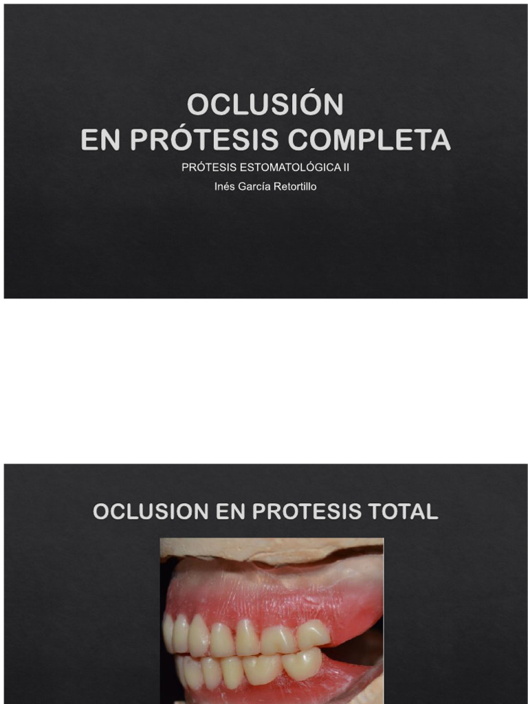 Occlusion in Complete Dentures | PDF | Mouth | Dentistry Branches