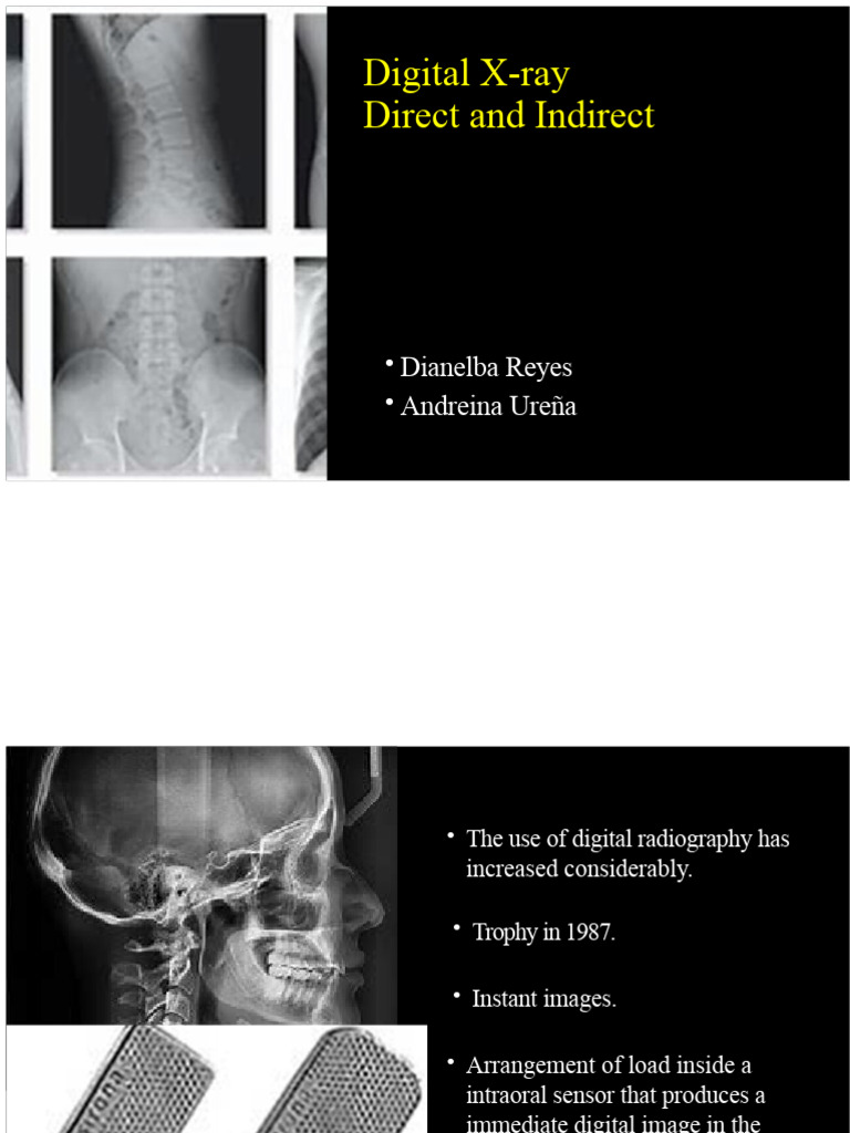 Direct and Indirect Digital Radiographies | PDF