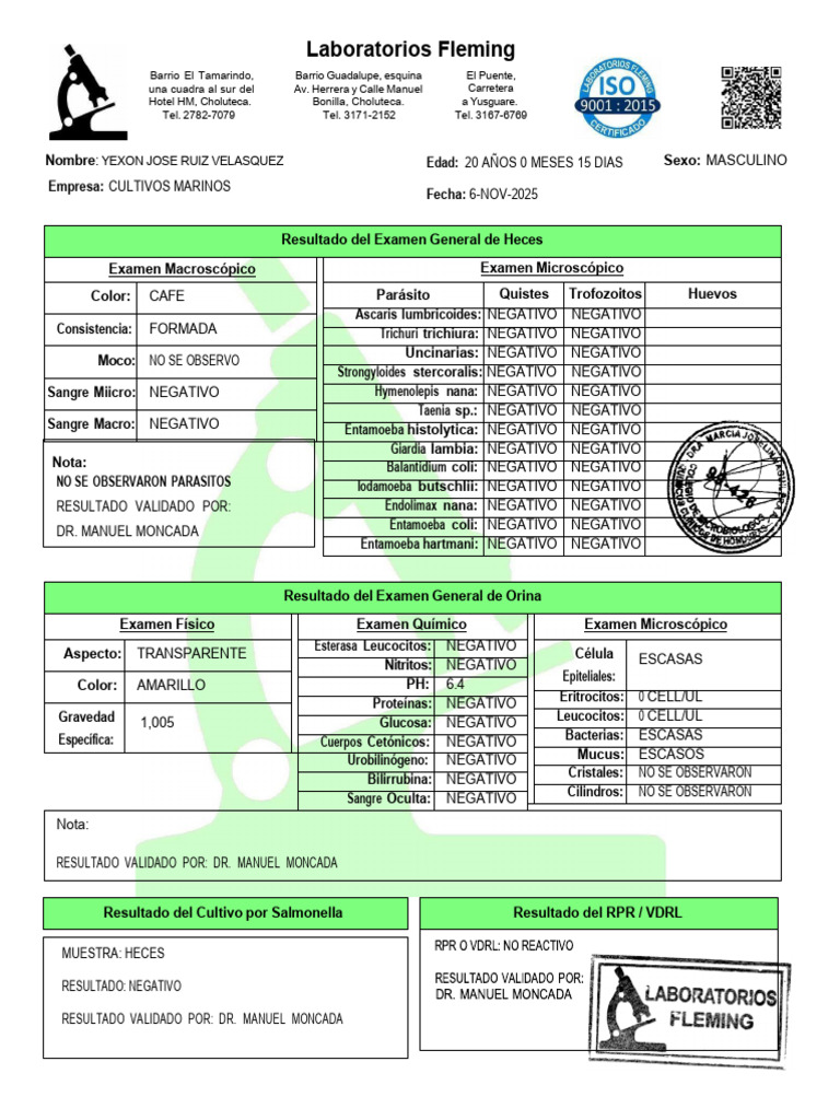 YEXON | PDF