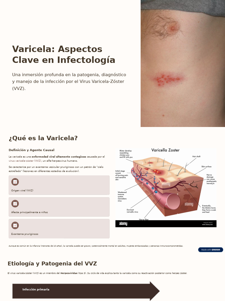 Varicela | PDF | Microbiología | Medicina CLINICA