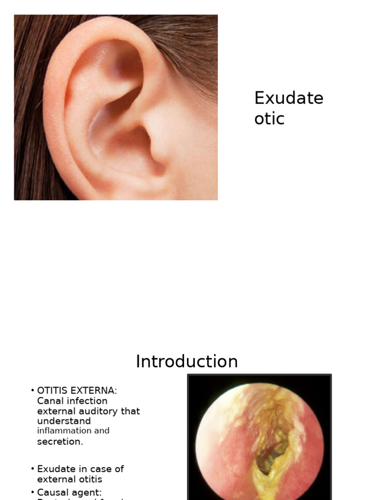 Ear Exudate and Stool Culture | PDF | Diarrhea | Microbiology