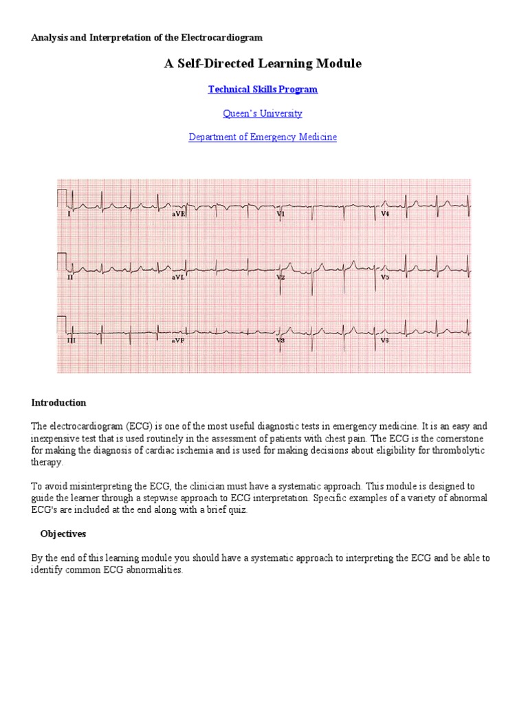 ECG Module Printable | PDF | Electrocardiography | Cardiac Arrhythmia
