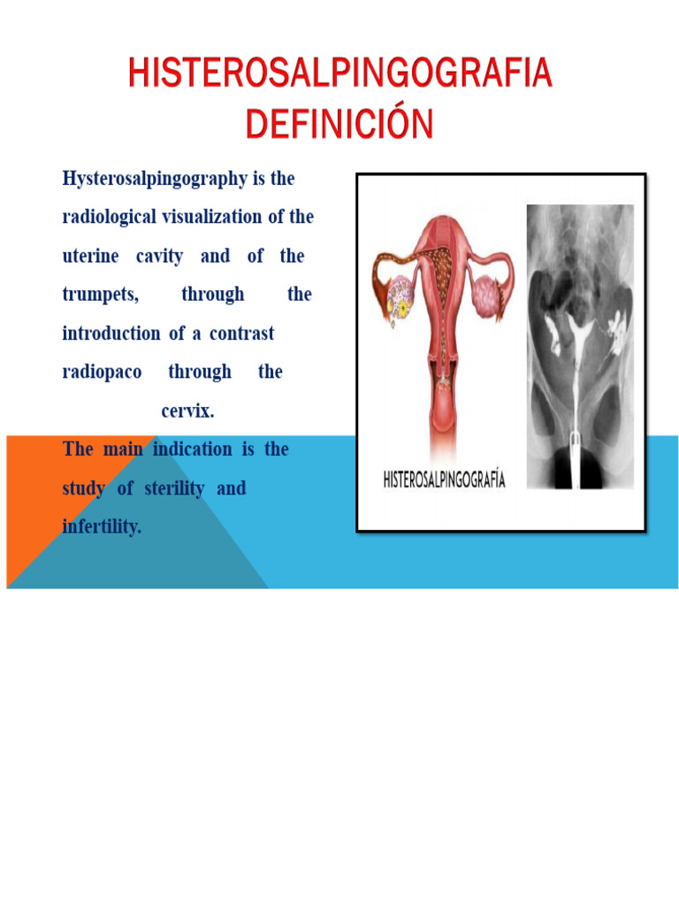 Hysterosalpingography | PDF