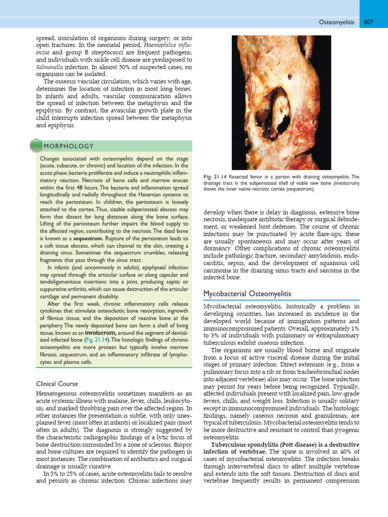 Robbins Basic Pathology 10th Edition | PDF | Bone | Benign Tumor