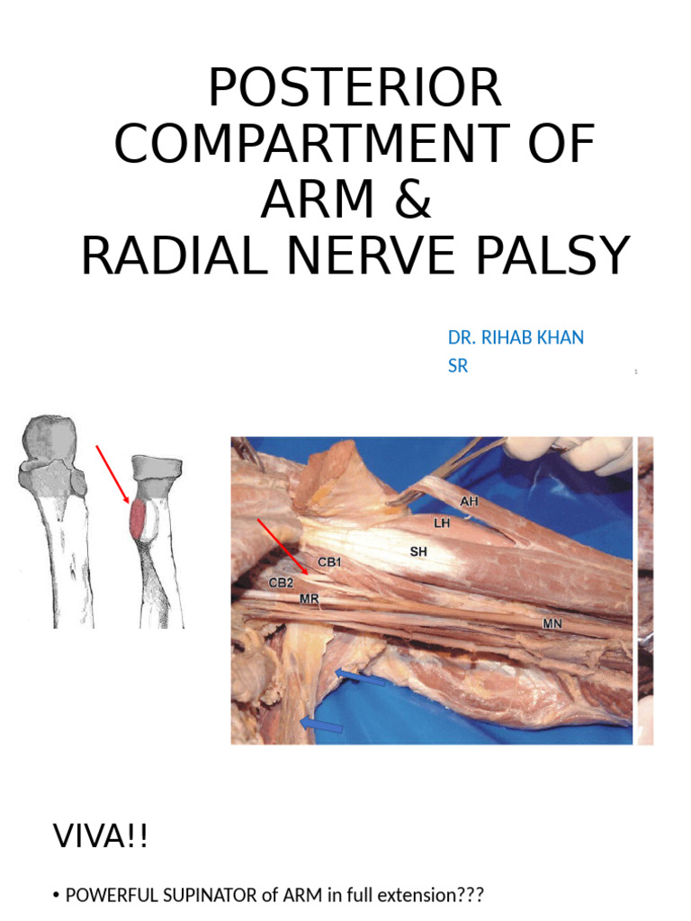 Chapter 13 Posterior of Arm | PDF | Arm | Elbow