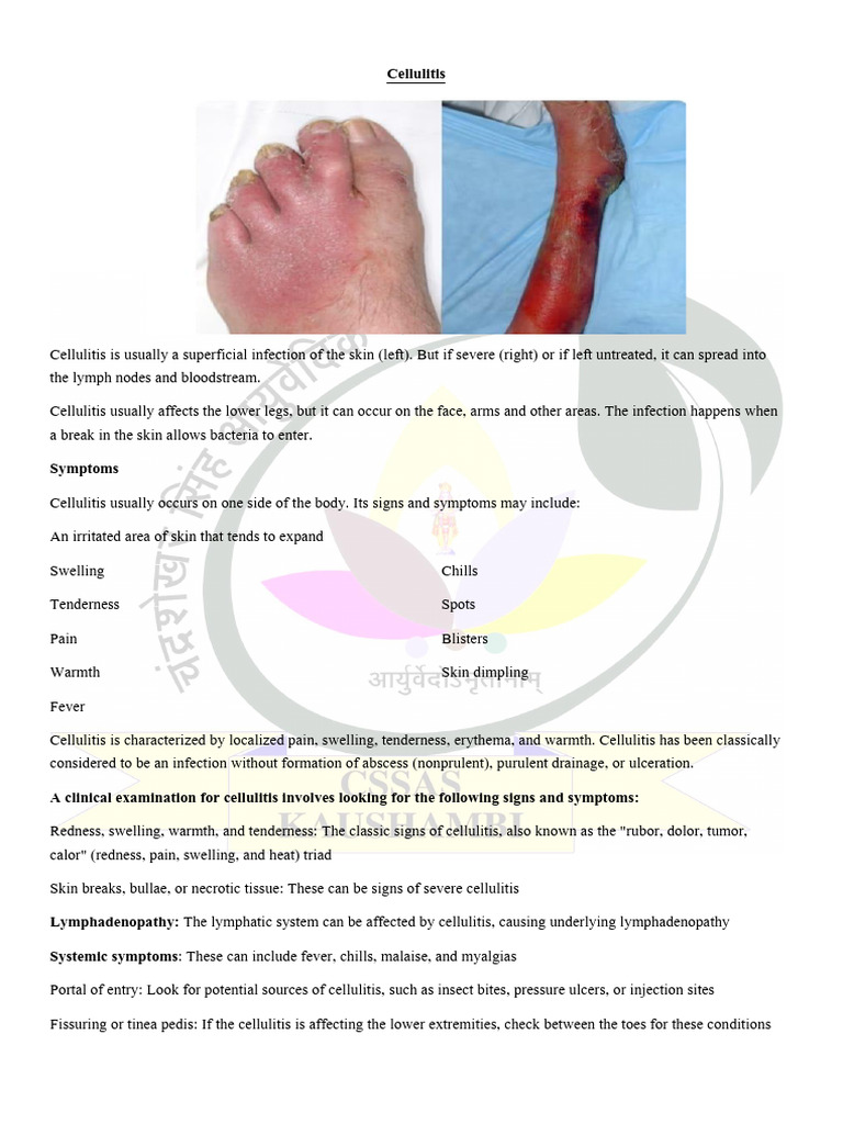 Understanding Cellulitis Symptoms and Risks | PDF