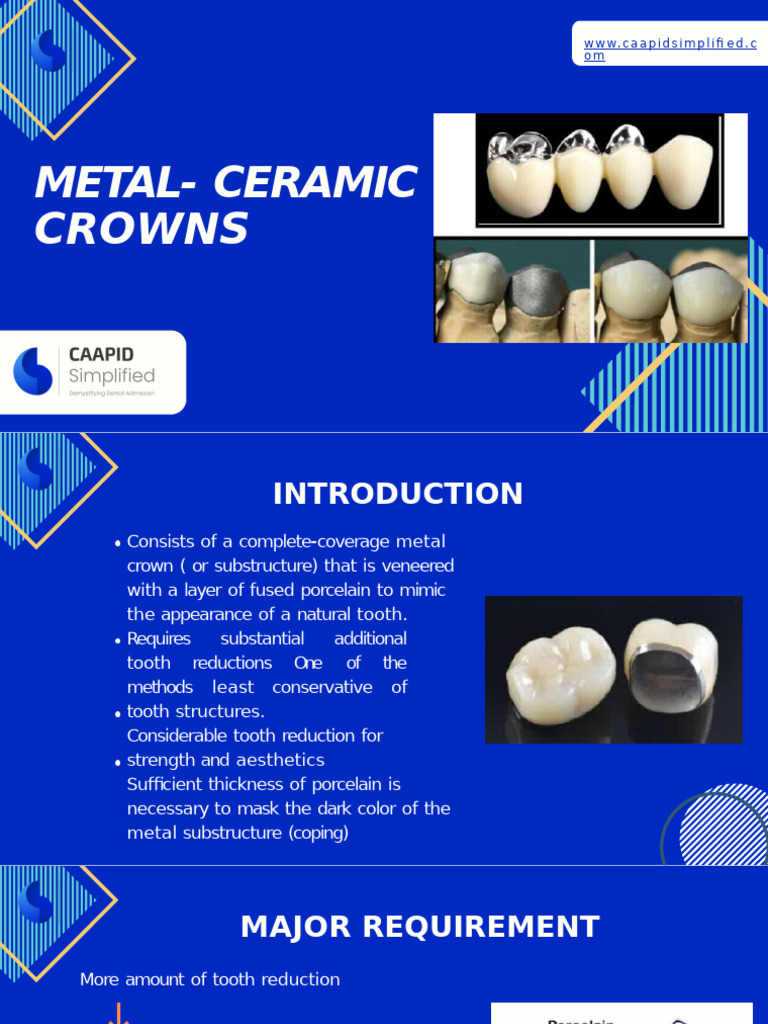 Metal-Ceramic Crown Preparation Guide | PDF | Tooth | Dental Anatomy