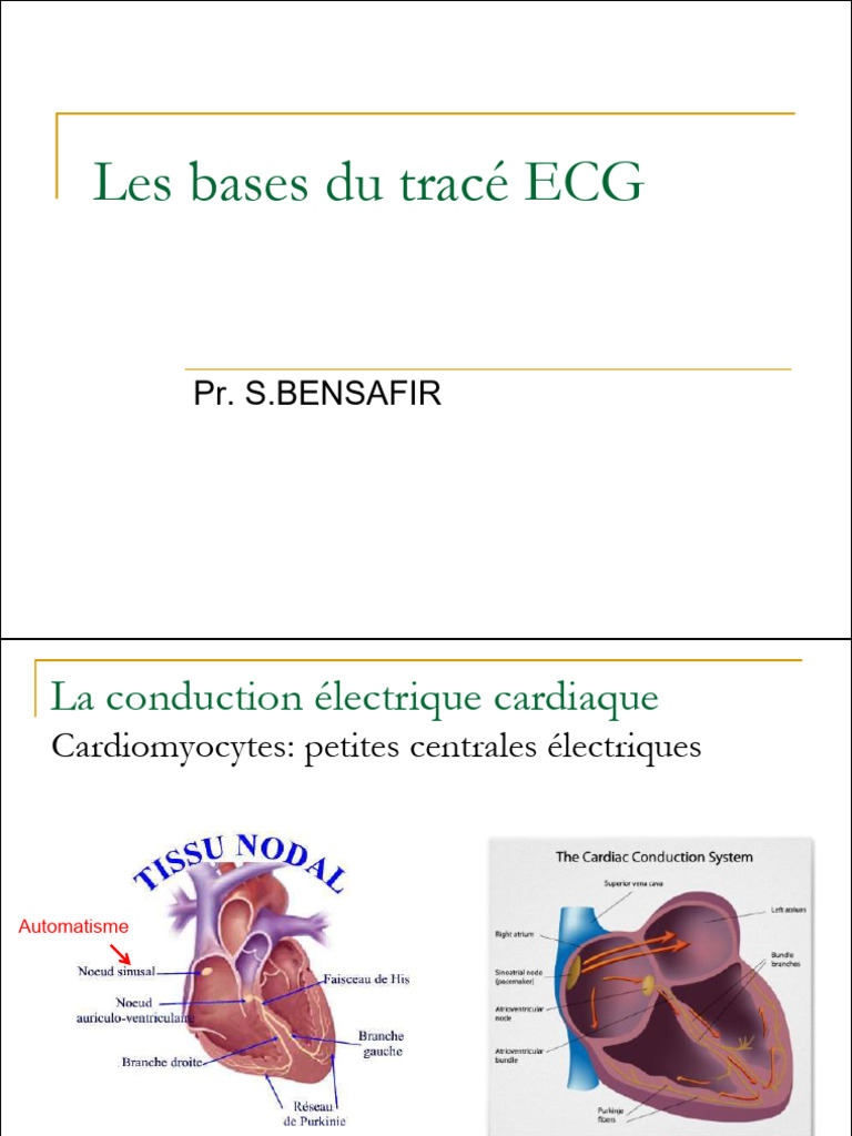 Introduction au tracé ECG | PDF | Électrocardiographie | Physiologie
