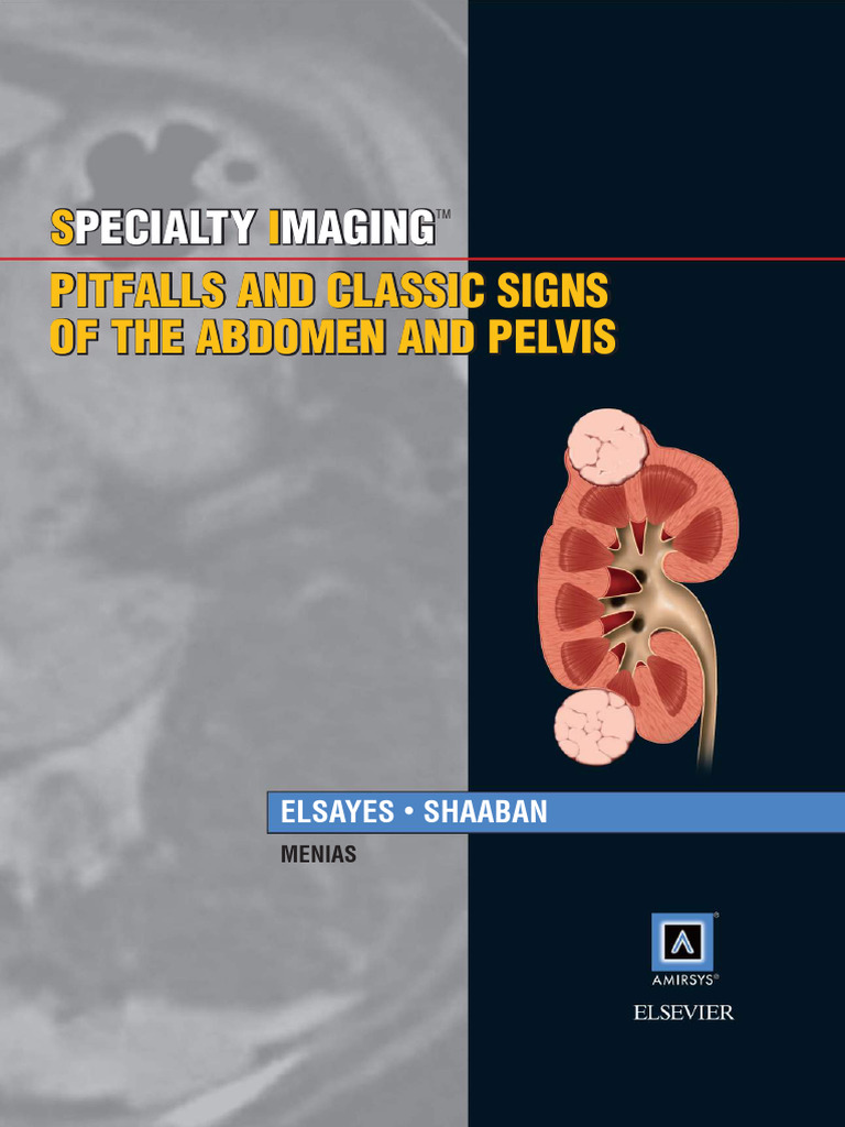 Specialty Imaging - Pitfalls and Classic Signs of The Abdomen and ...