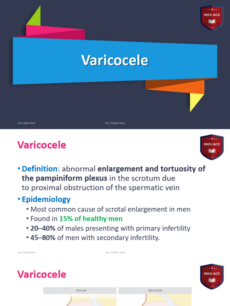 Varicocele and Hydrocele Overview | PDF | Testicle | Clinical Medicine