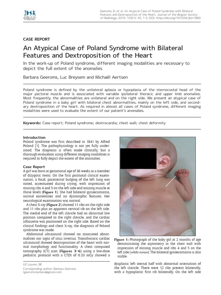 An Atypical Case of Poland Syndrome With Bilateral | PDF | Thorax | Heart