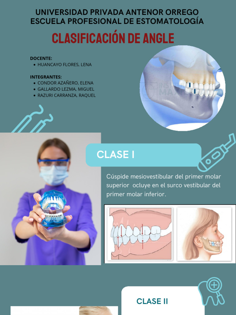 Clasificación de Angle en Maloclusiones | PDF | Ramas de Odontología | Boca