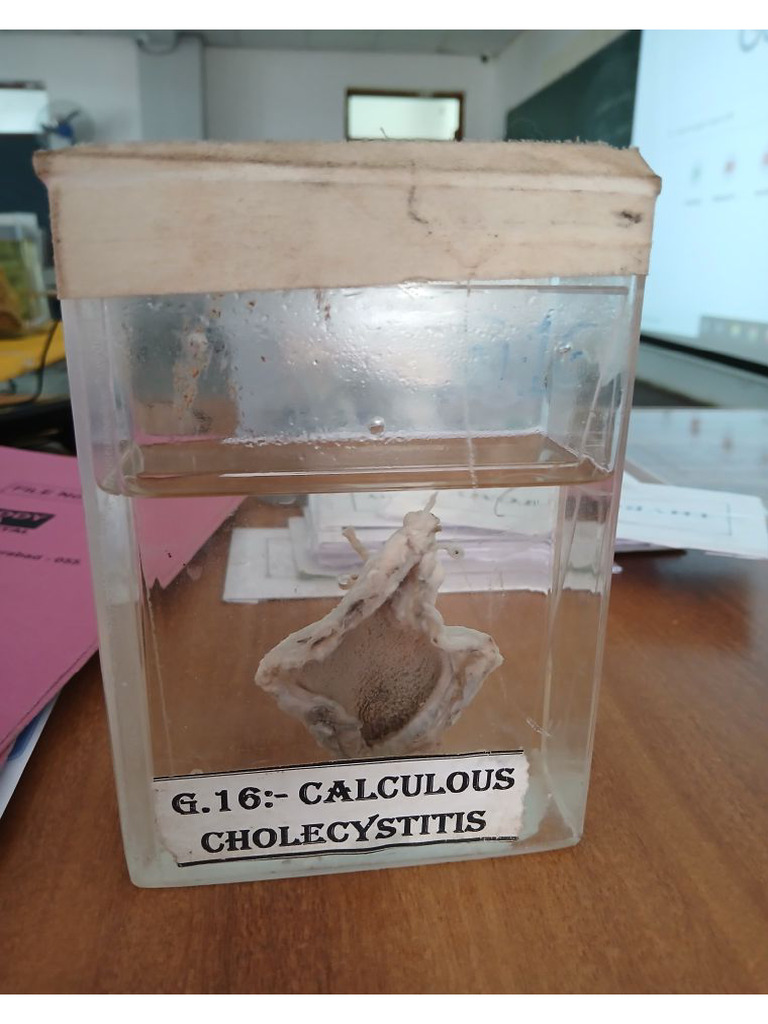 General Surgery Specimens | PDF